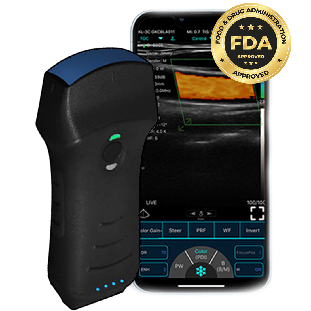 Dual Head Portable Wireless Probe Color Doppler Ultrasound Scanner ...